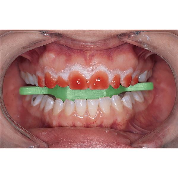 IsoBlock 10 ks | HUFA