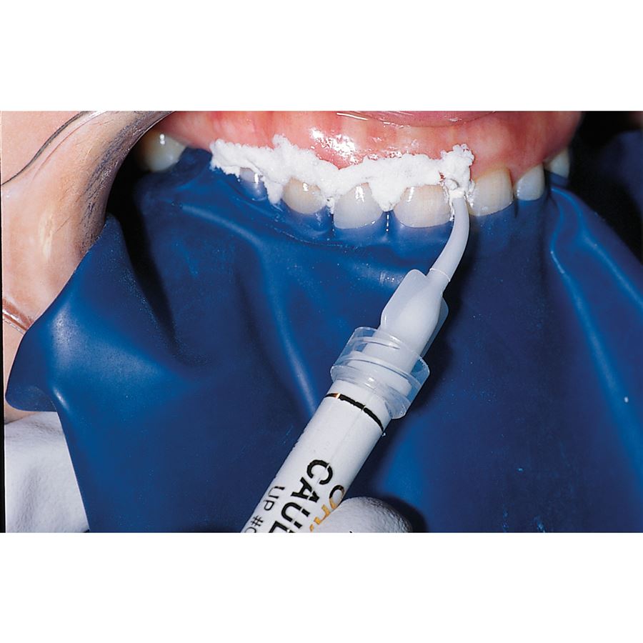 OraSeal tmel 4 x 1,2 ml | HUFA